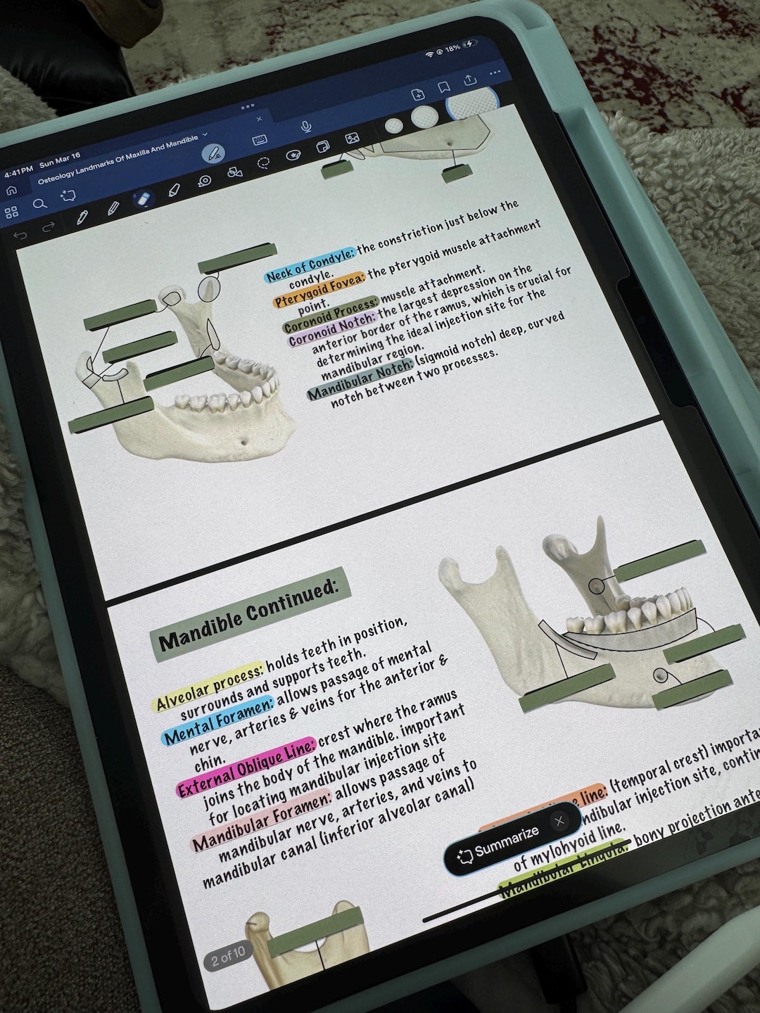 Oral Anatomy - Osteology - Maxilla and Mandible - Interactive Notes ...