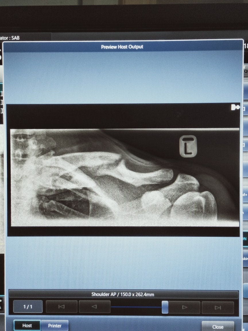 Xray Marker for Radiology and Xray. - Etsy