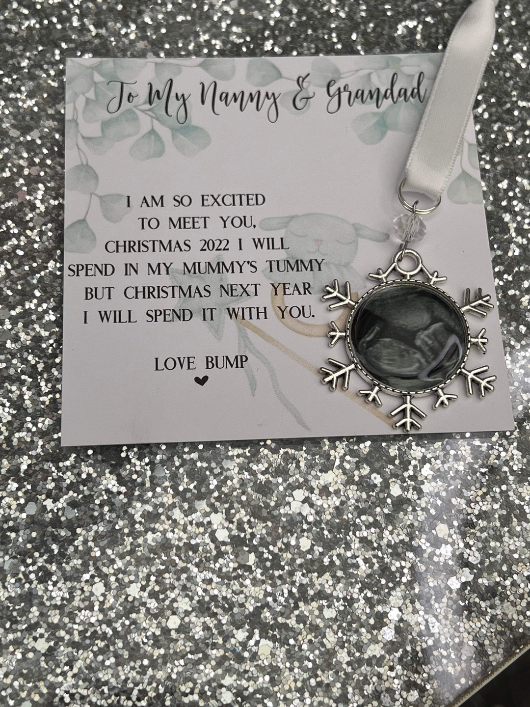 Personalised Ultrasound Baby Scan Photo Christmas Tree Bauble/stocking ...