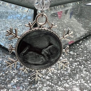 Personalised Ultrasound Baby Scan Photo Christmas Tree Bauble/stocking ...