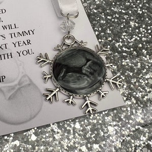 Personalised Ultrasound Baby Scan Photo Christmas Tree Bauble/stocking ...