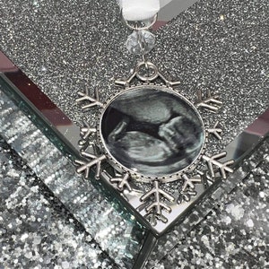 Personalised Ultrasound Baby Scan Photo Christmas Tree Bauble/stocking ...