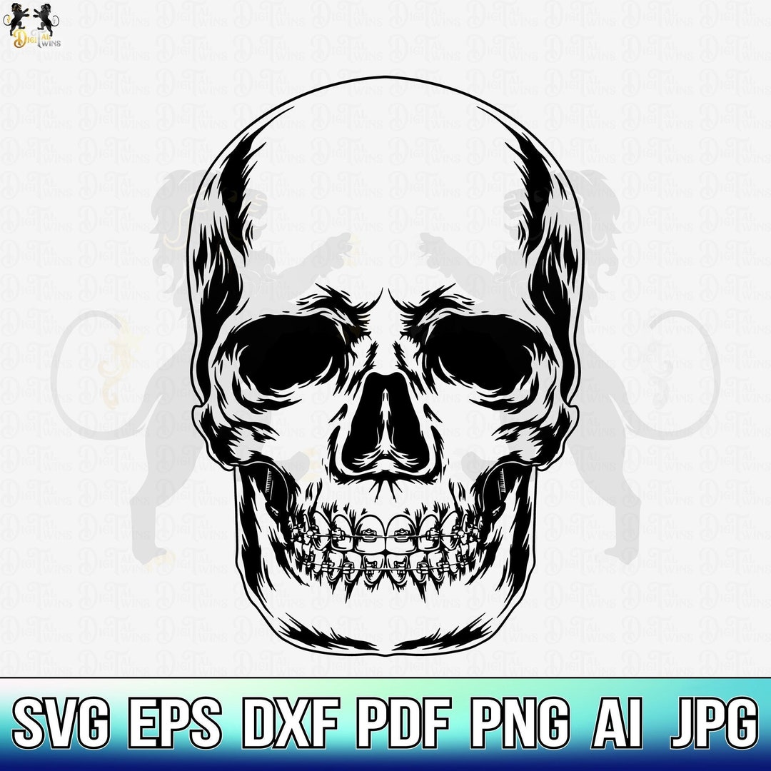 Skull With Braces Svg, Skull Svg, Skull Clipart, Skull Vector, Skull ...