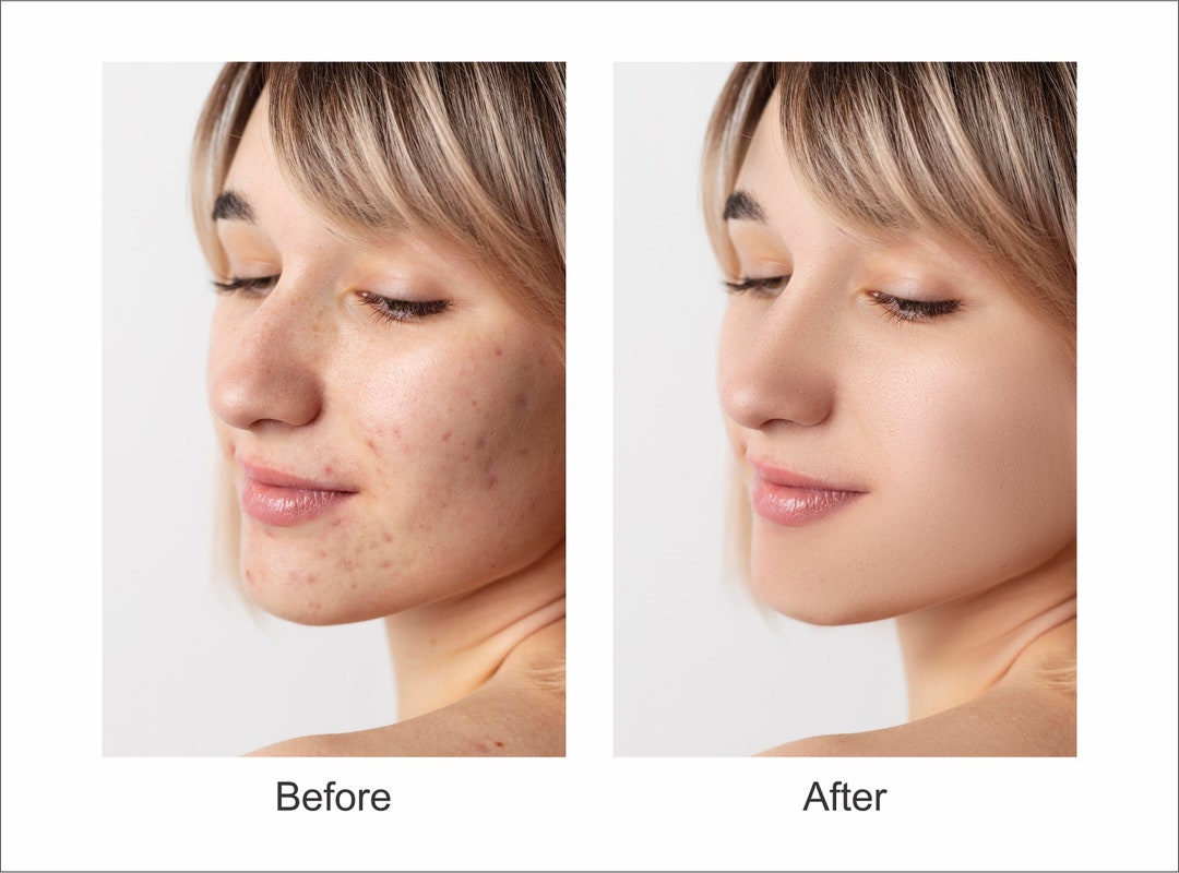 Photo Edit Service Using Photoshop, Professional Phot Editing, Photo ...