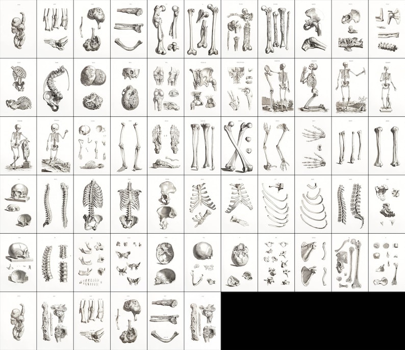 61 Osteographia Vintage Anatomy of Bones Illustrations | Image Bundle ...