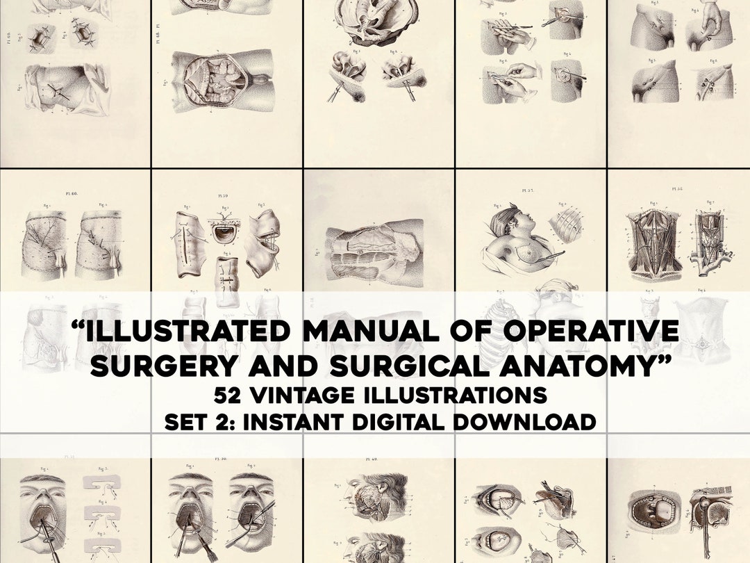 52 Illustrated Operations of Anatomy Phys Medical Surgeon Dissect ...