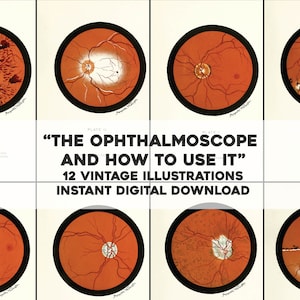 12 Awesome Ophthalmoscope Eye Doctor Disorder Reference Illustrations ...