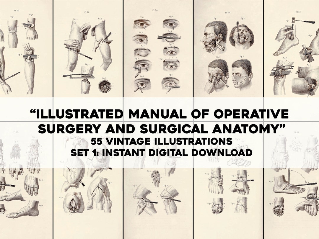55 Illustrated Operations of Anatomy Phys Medical Surgeon Dissect ...