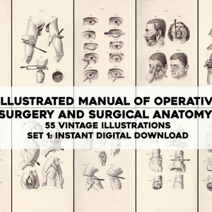 55 Illustrated Operations of Anatomy Phys Medical Surgeon Dissect ...