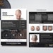 DIY SMP Flyer, Scalp Micropigmentation Flyer Templates Design, Hairline ...