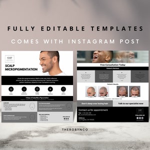 DIY SMP Flyer, Scalp Micropigmentation Flyer Templates Design, Hairline ...