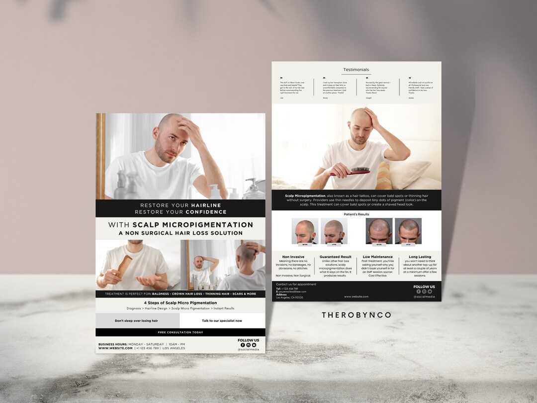 DIY SMP Flyer, Scalp Micropigmentation Flyer Templates Design, Hairline ...