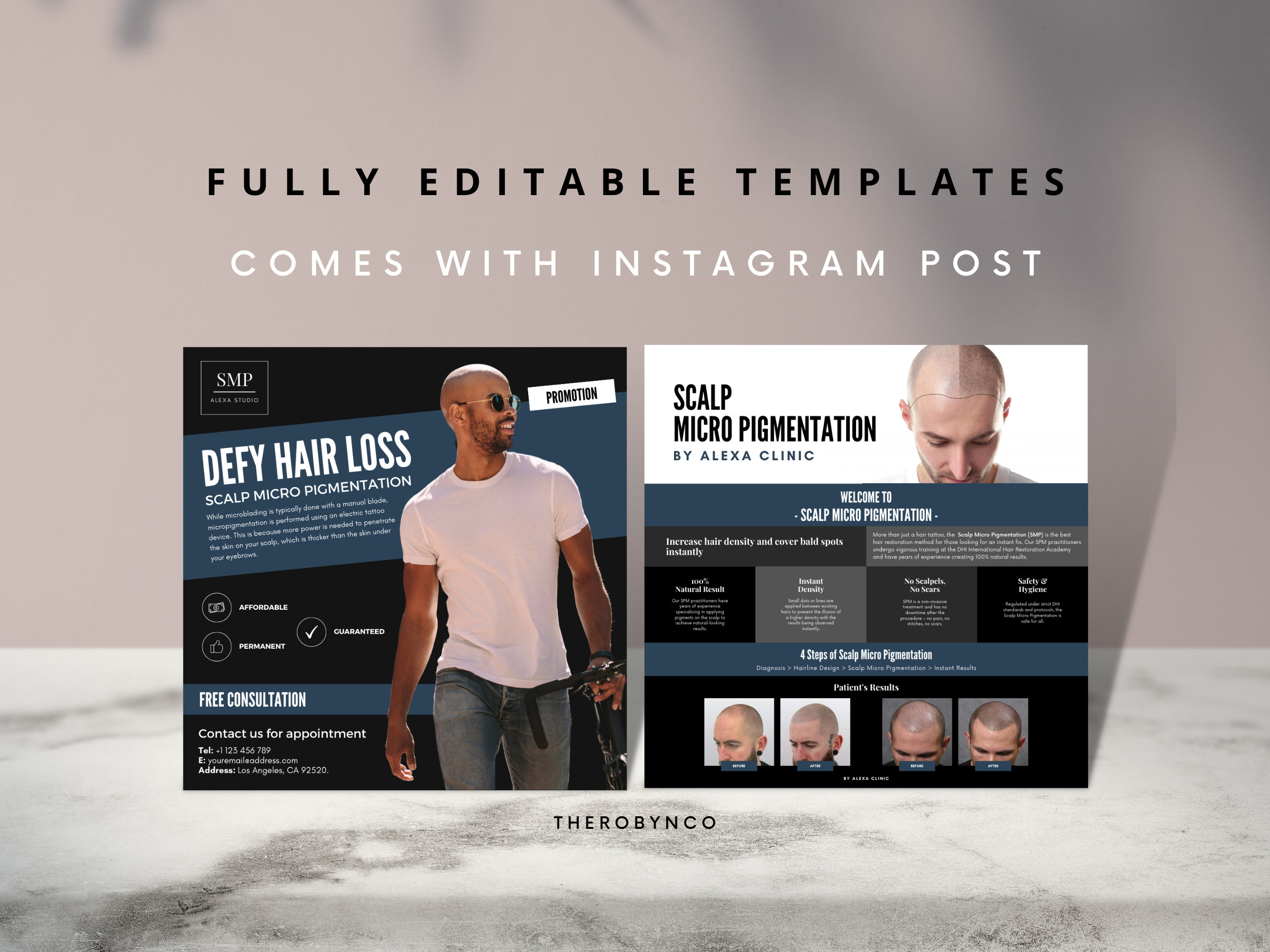 DIY SMP Flyer Scalp Micropigmentation Flyer Templates Design - Etsy