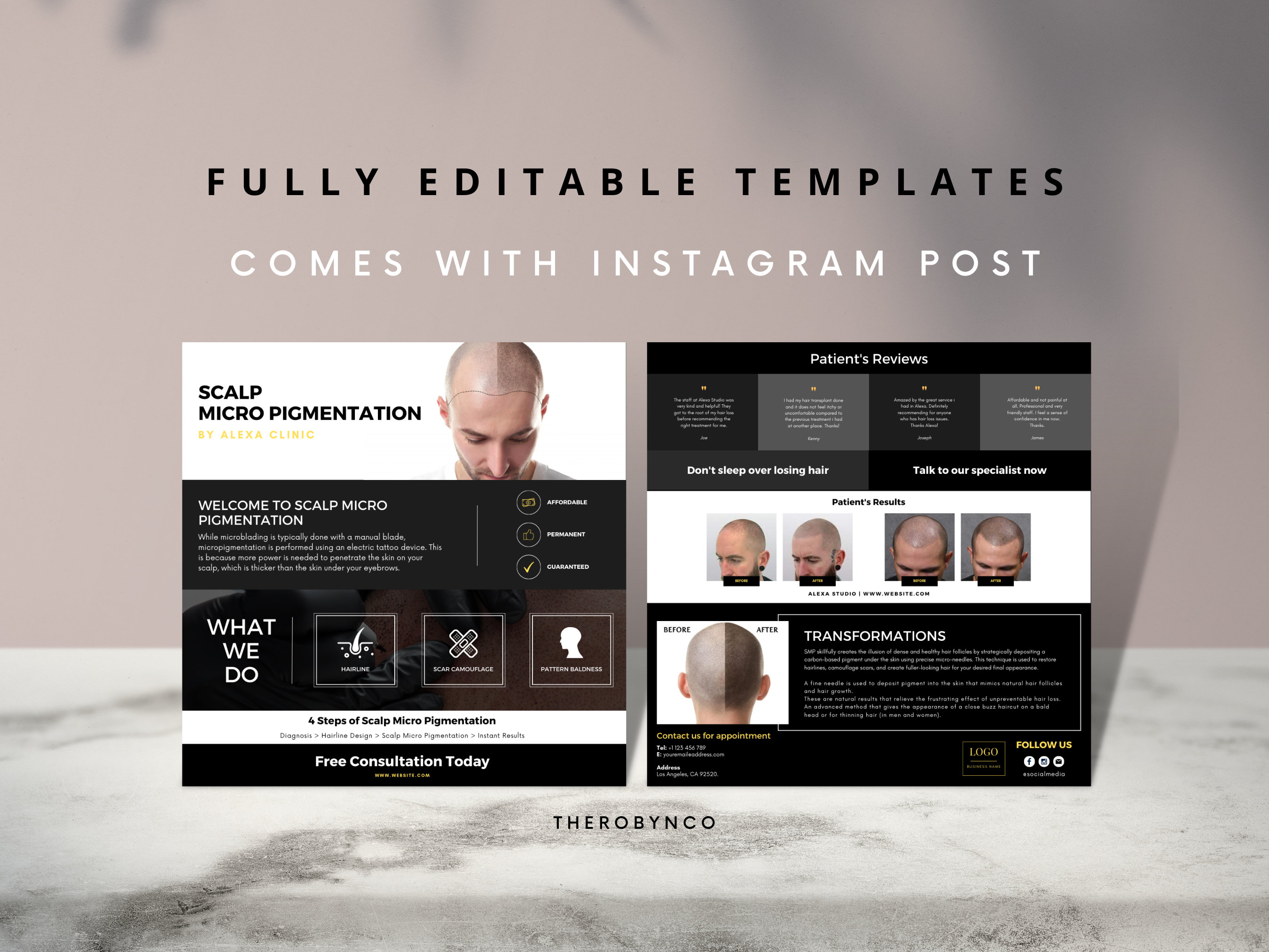 DIY SMP Flyer Scalp Micropigmentation Flyer Templates Design - Etsy Canada