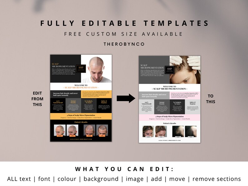DIY SMP Flyer Scalp Micropigmentation Flyer Templates Design - Etsy