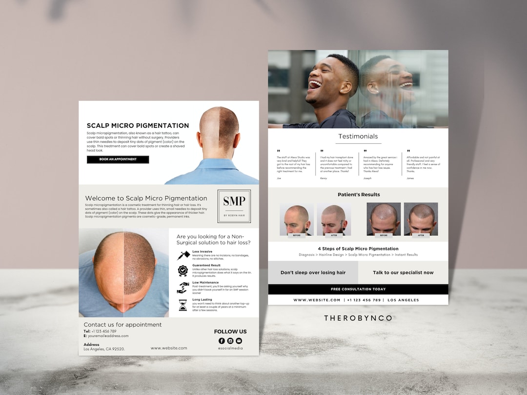DIY SMP Flyer, Scalp Micropigmentation Flyer Templates Design, Hairline ...