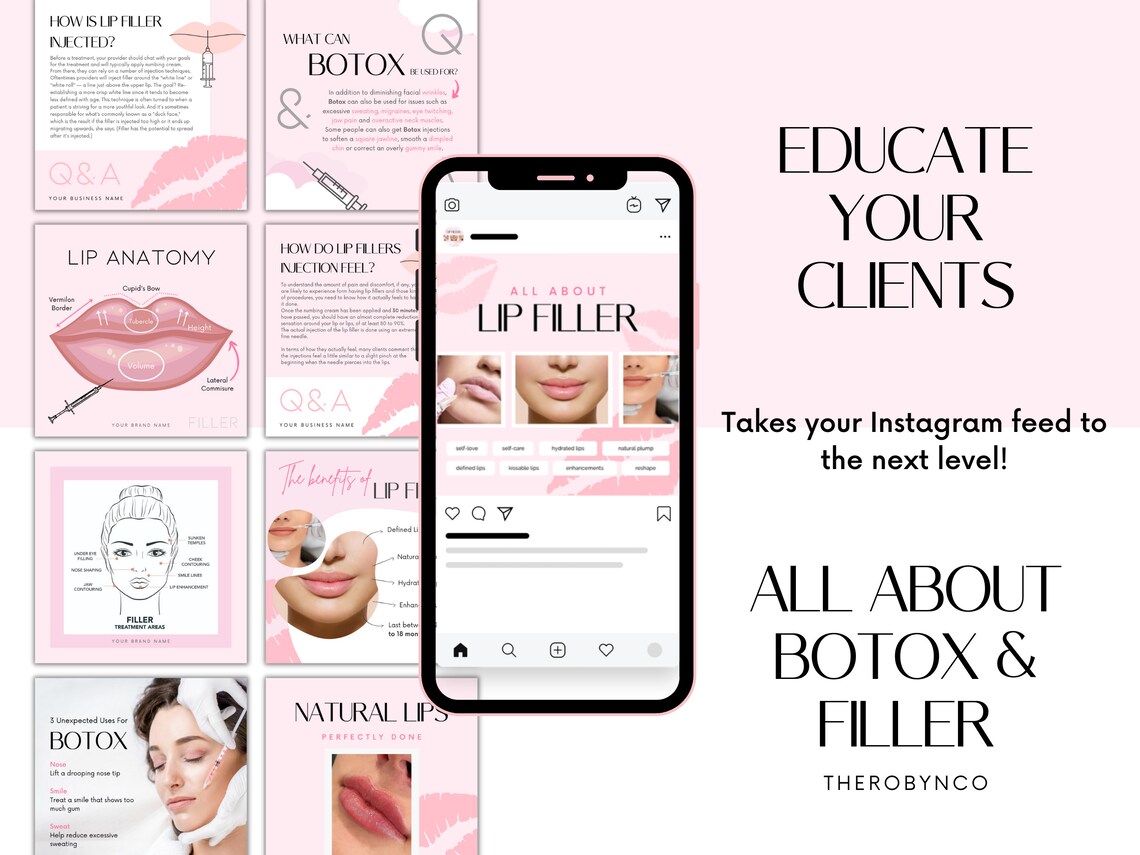 DIY 60 Botox and Filler Instagram Post Templates Content | Etsy