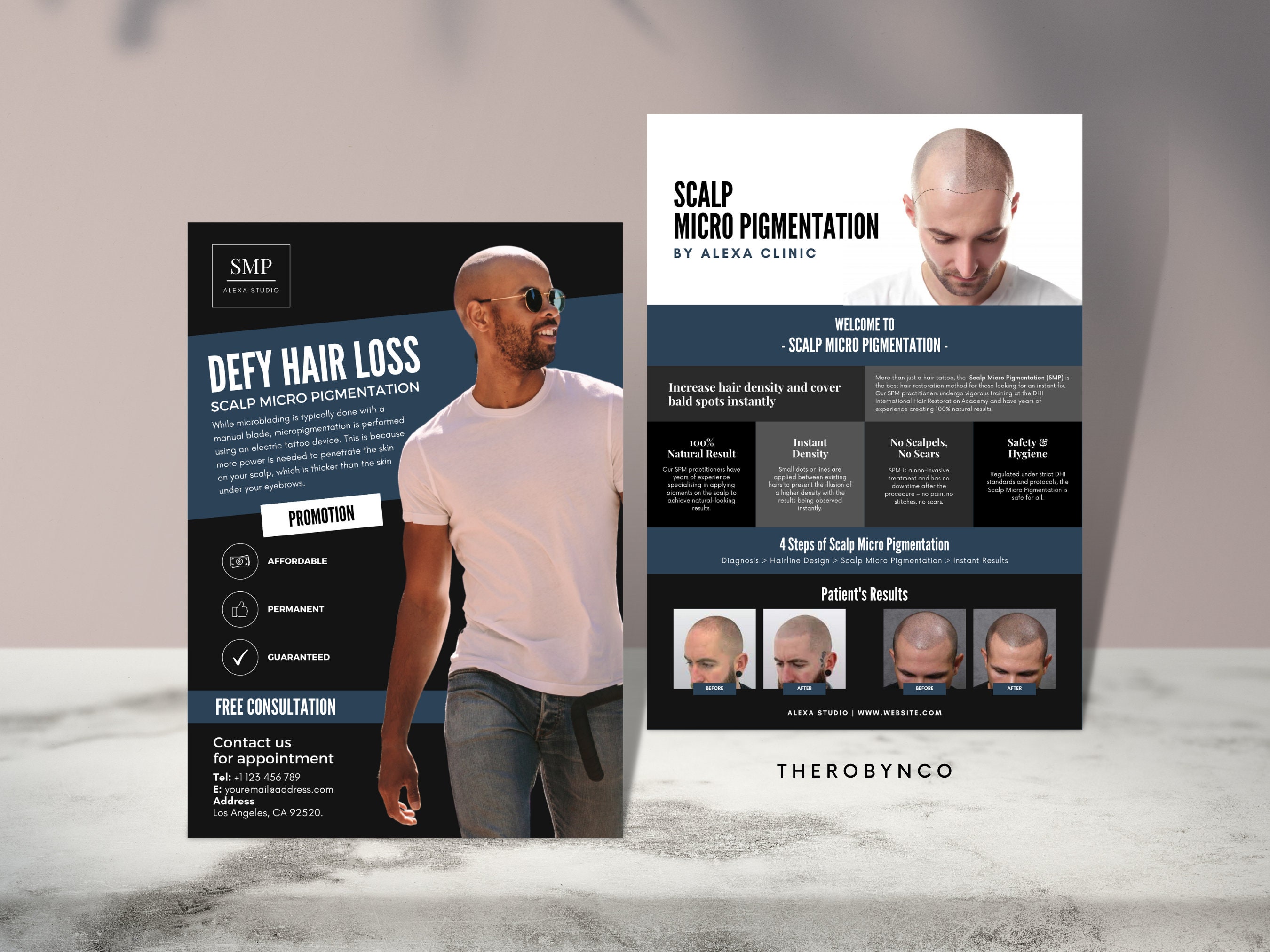 DIY SMP Flyer Scalp Micropigmentation Flyer Templates Design - Etsy