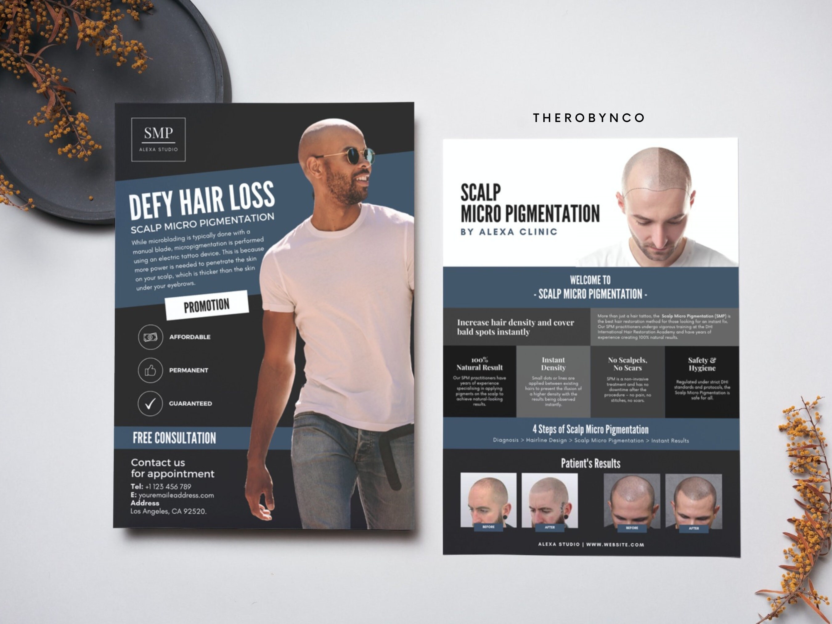 DIY SMP Flyer Scalp Micropigmentation Flyer Templates Design - Etsy