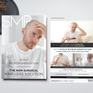 DIY SMP Flyer, Scalp Micropigmentation Flyer Templates Design, Hairline ...