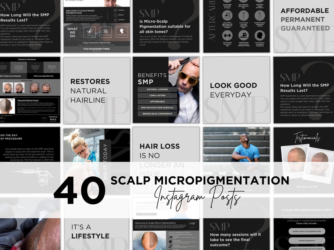 DIY SMP Flyer Instagram Templates, Scalp Micropigmentation Flyer Design ...