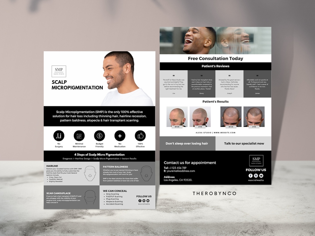 DIY SMP Flyer, Scalp Micropigmentation Flyer Templates Design, Hairline ...
