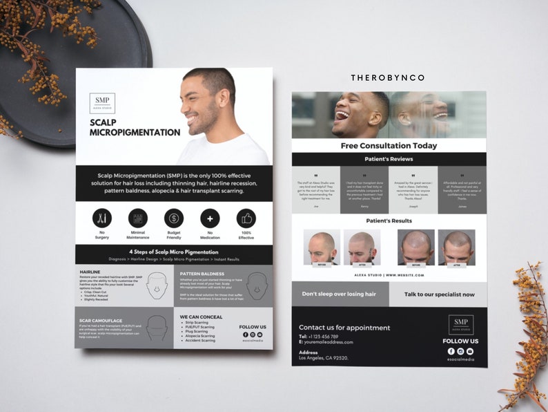 DIY SMP Flyer, Scalp Micropigmentation Flyer Templates Design, Hairline ...