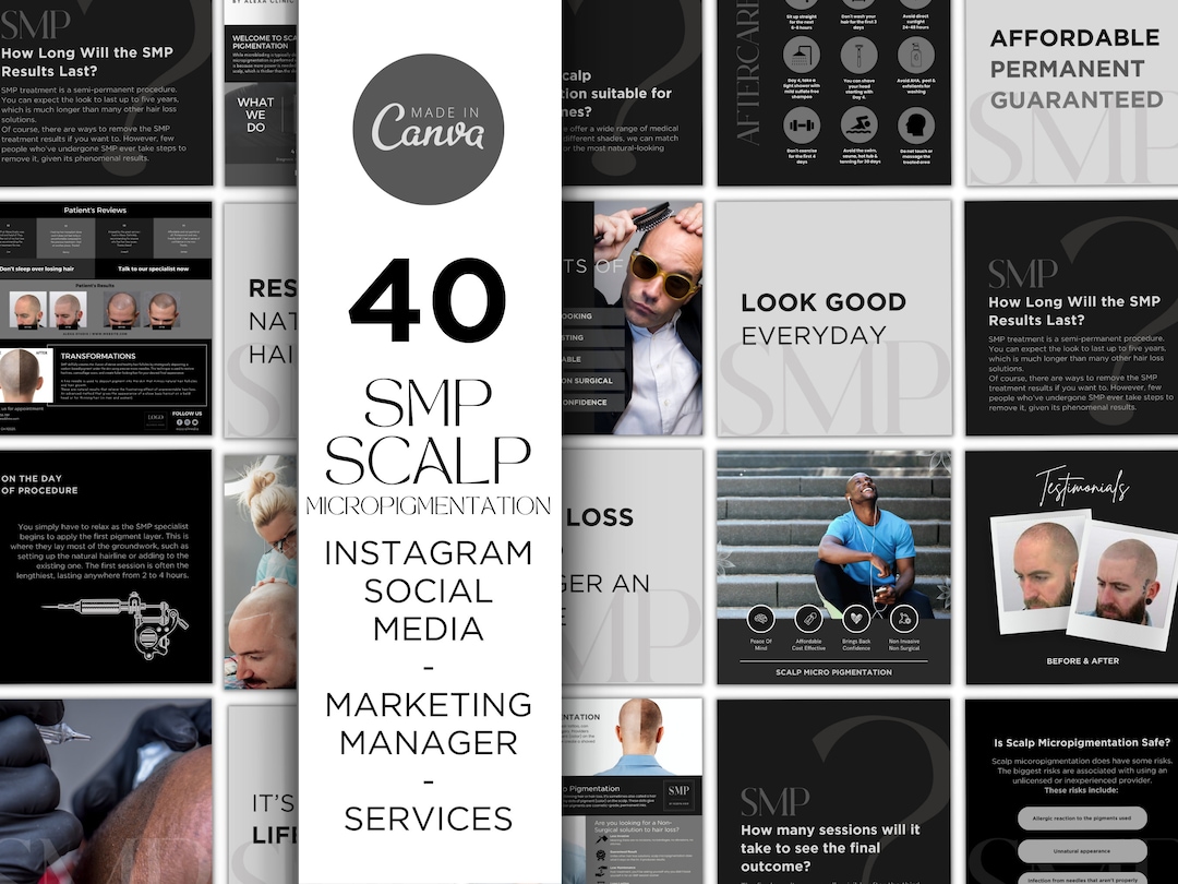 DIY SMP Flyer Instagram Templates, Scalp Micropigmentation Flyer Design ...