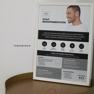 DIY SMP Flyer, Scalp Micropigmentation Flyer Templates Design, Hairline ...