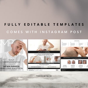 DIY SMP Flyer, Scalp Micropigmentation Flyer Templates Design, Hairline ...