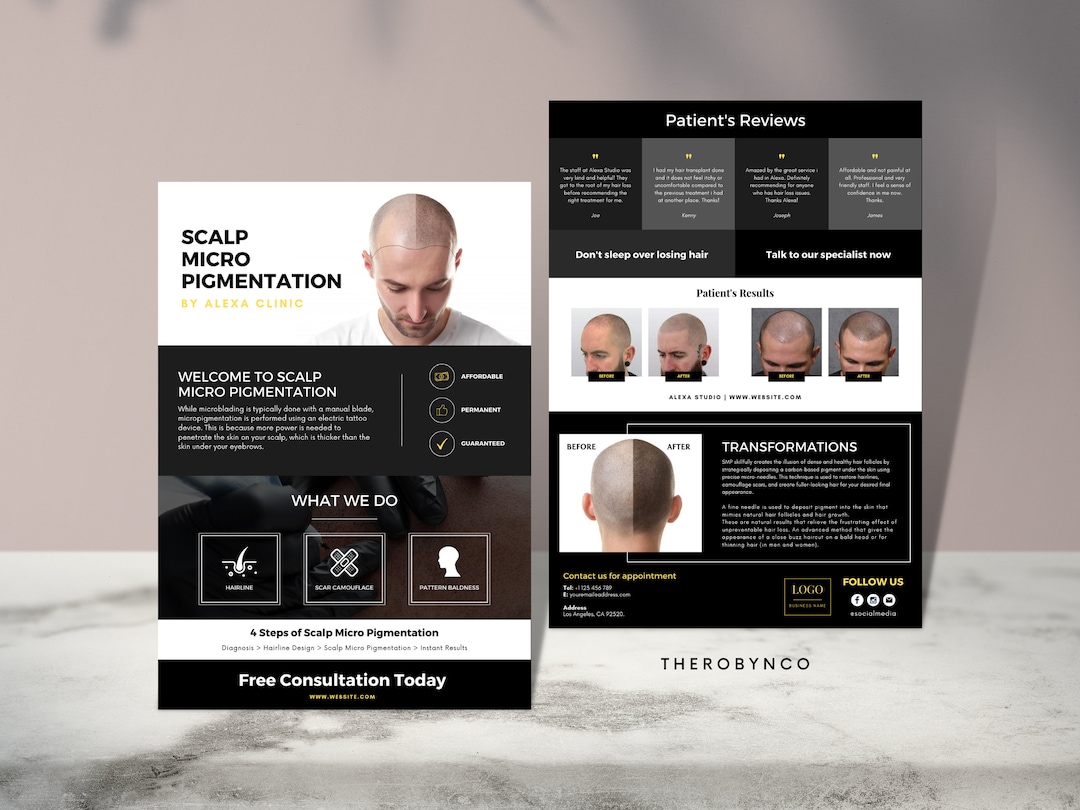 DIY SMP Flyer, Scalp Micropigmentation Flyer Templates Design, Hairline ...
