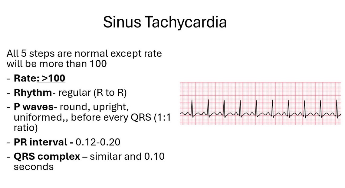 EKG Made Easy for Medical Professional - Etsy