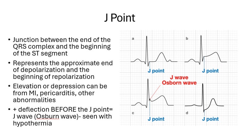 EKG Made Easy for Medical Professional - Etsy