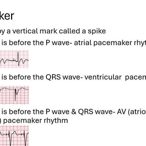 EKG Made Easy for Medical Professional - Etsy