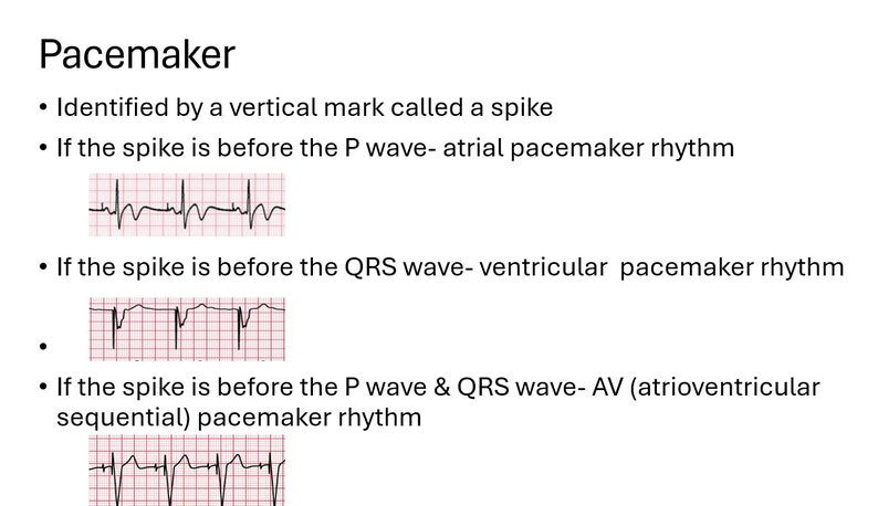 EKG Made Easy for Medical Professional - Etsy