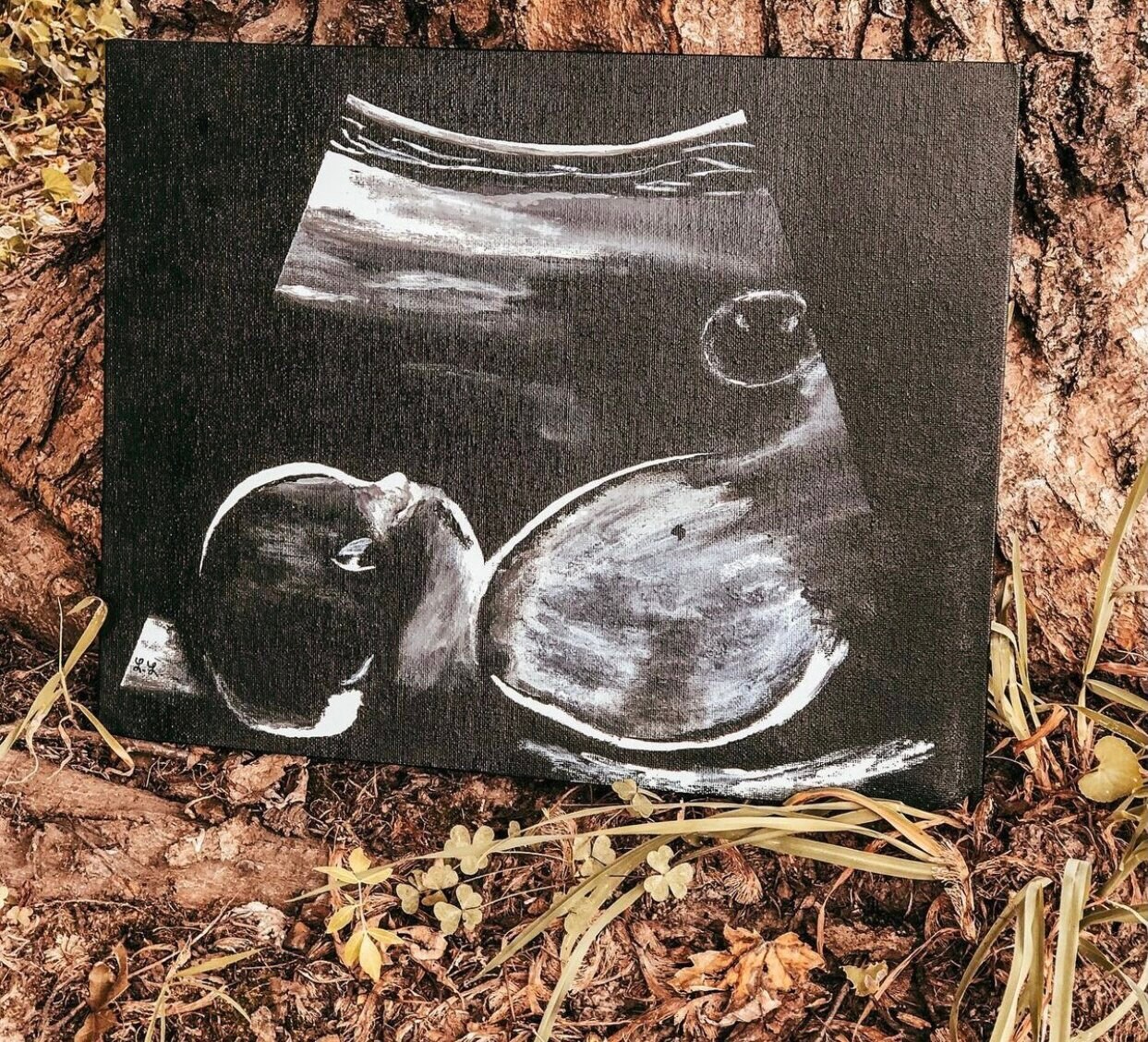 Sonogram Painting - Etsy