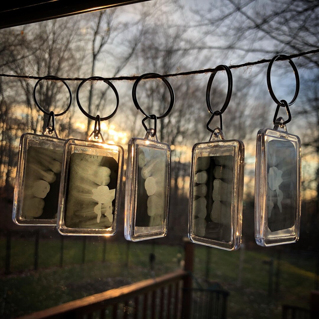 Dental X-ray Keychain - Etsy