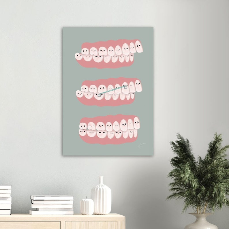 Cute Teeth Poster Orthodontist Office Decor Teeth Alignment Anatomy ...