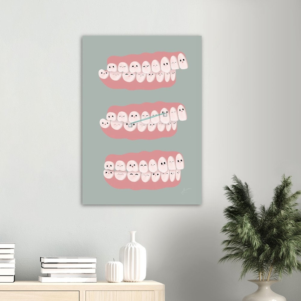 Cute Teeth Anatomy Poster | Orthodontist Office Decor, Sage Green - Etsy