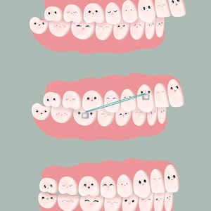 Cute Teeth Poster Orthodontist Office Decor || Teeth Alignment Anatomy ...