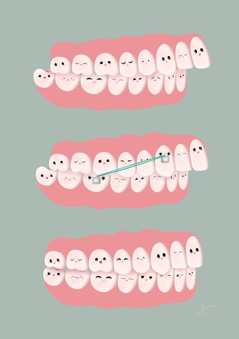 Cute Teeth Poster Orthodontist Office Decor Teeth Alignment Anatomy ...