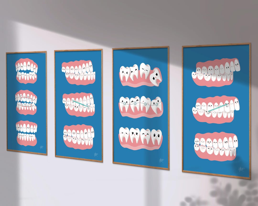Printable Orthodontics Art Set | 4 Digital Dental Anatomy Illustrations ...