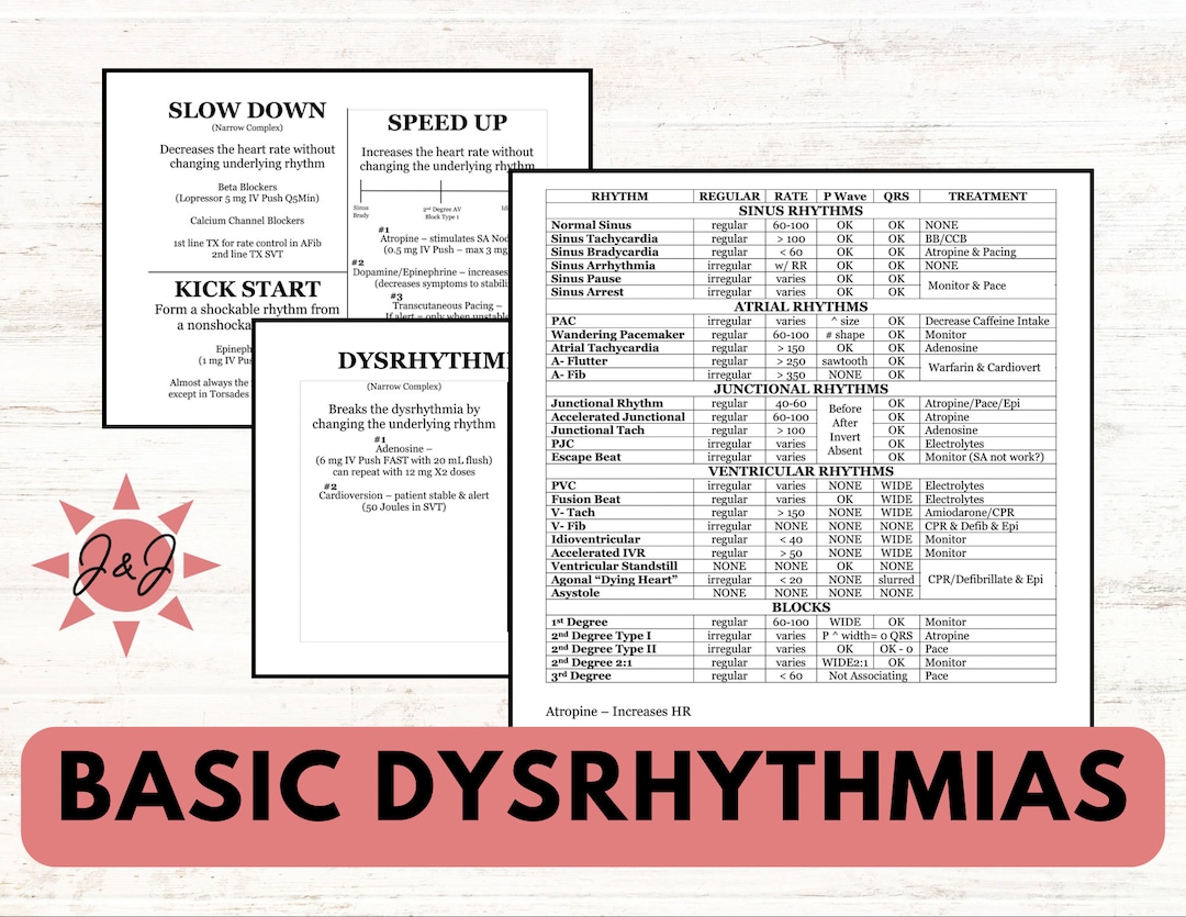 EKG Tips. Dysrhythmias ICU Nurse, Tele Nurse, ER Nurse. Cheat Sheet ...
