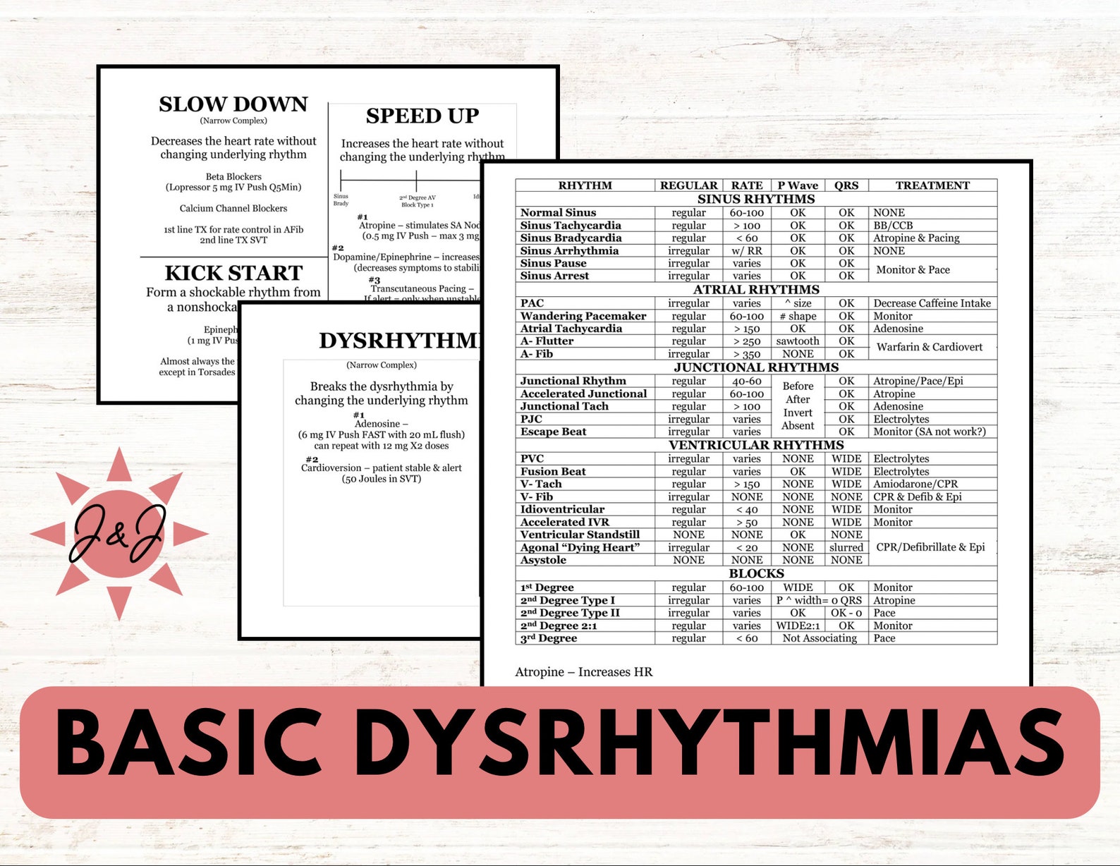 EKG Tips. Dysrhythmias ICU Nurse, Tele Nurse, ER Nurse. Cheat Sheet ...