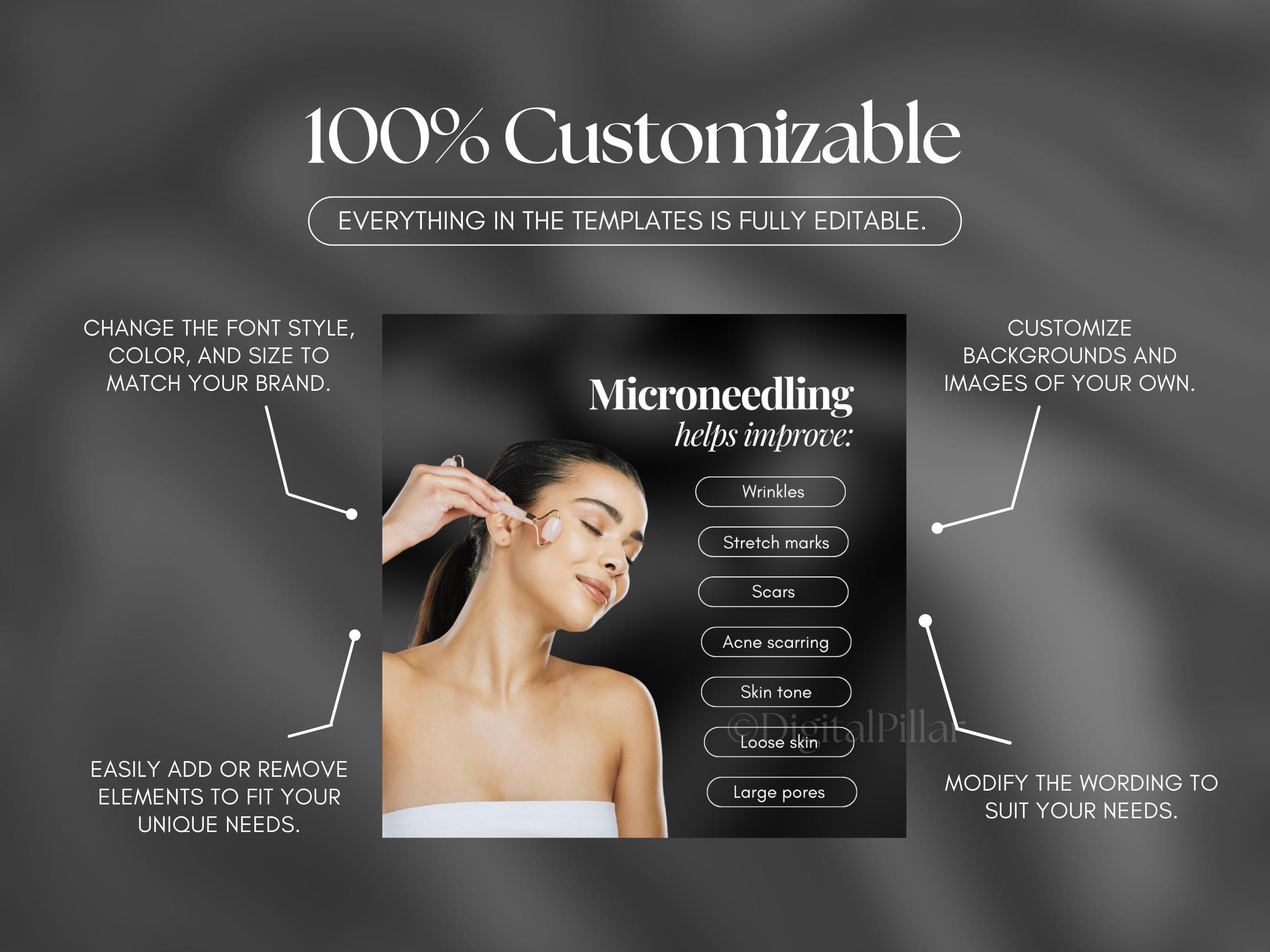 200 Microneedling Instagram Templates | Luxury Black Microneedling ...