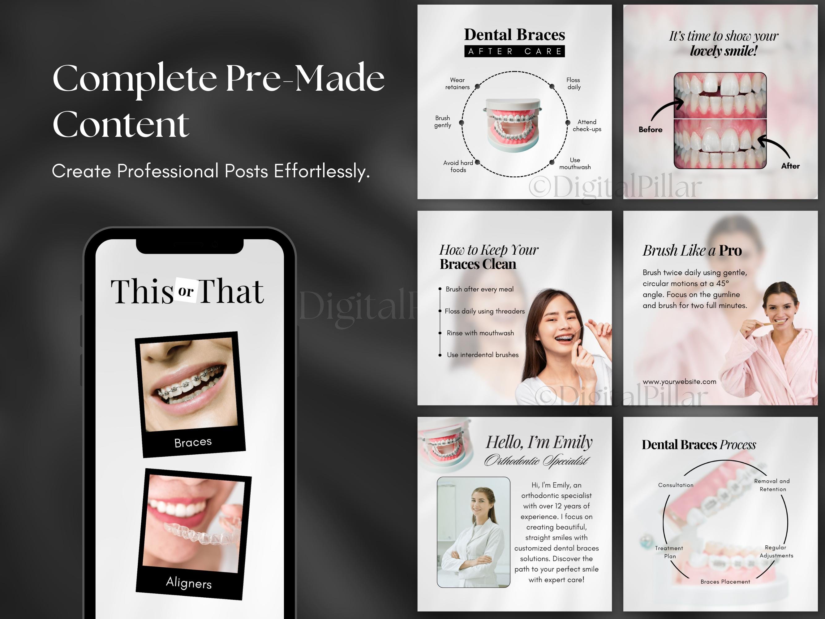 200 Dental Braces Instagram Templates | Orthodontist Instagram Posts ...