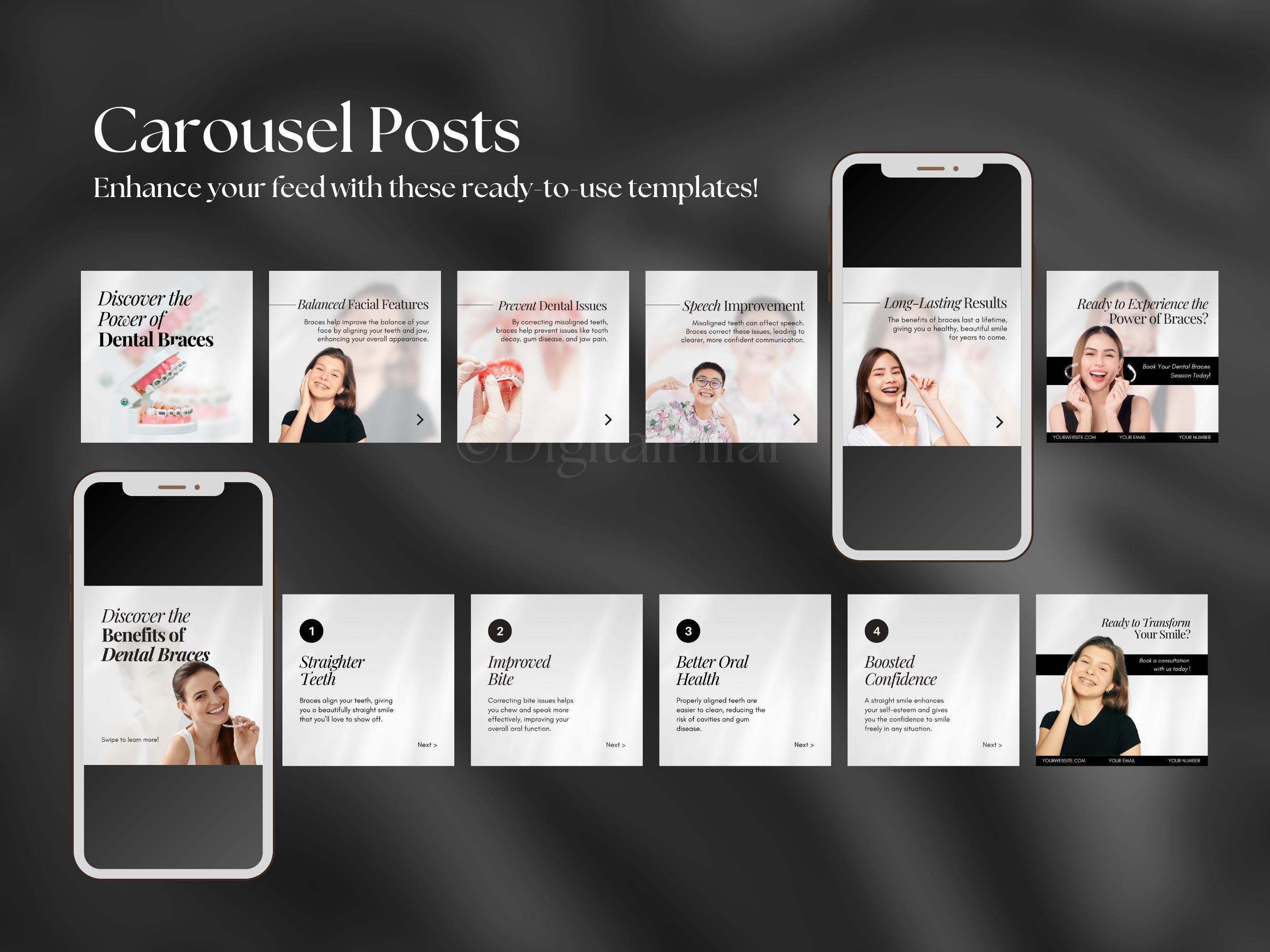 200 Dental Braces Instagram Templates | Orthodontist Instagram Posts ...