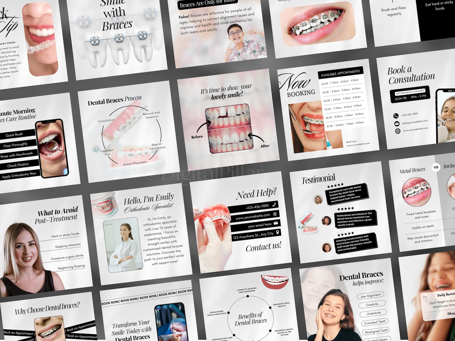 200 Dental Braces Instagram Templates | Orthodontist Instagram Posts ...