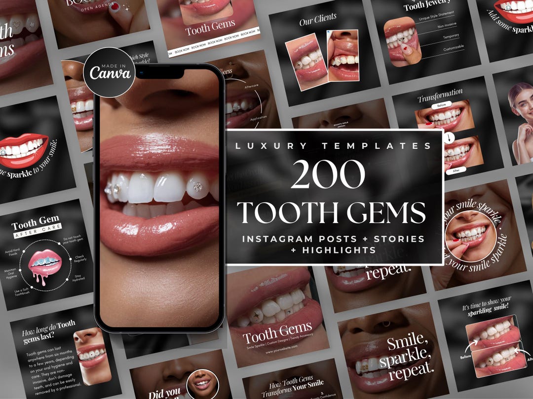 200 Tooth Gem Instagram Templates | Luxury Black Tooth Jewelry Posts ...