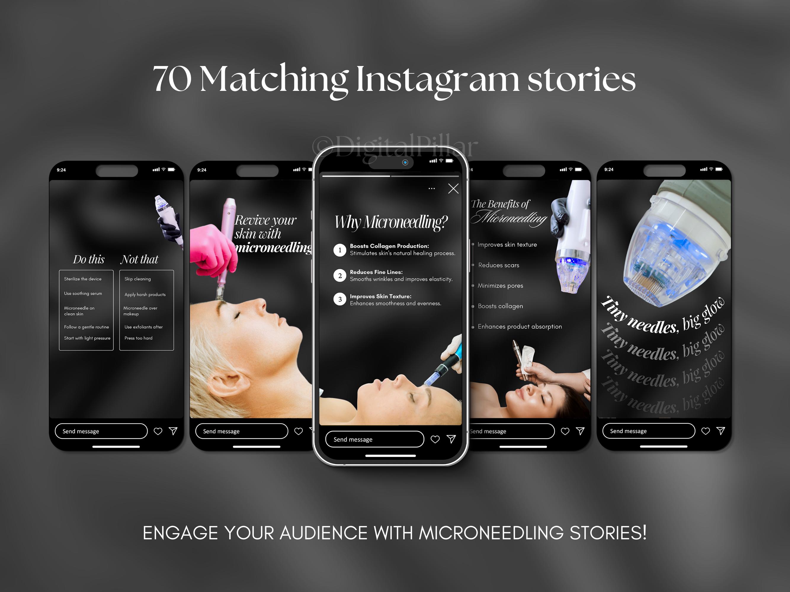 200 Microneedling Instagram Templates | Luxury Black Microneedling ...